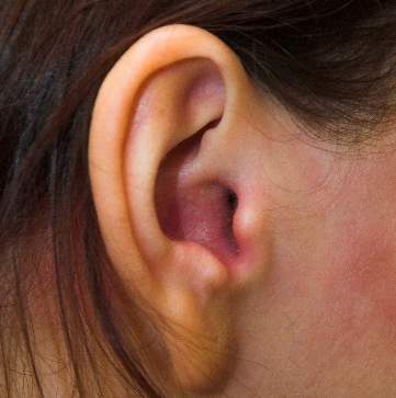 Fungus infection of the Ear-Otomycosis | Dr Paulose